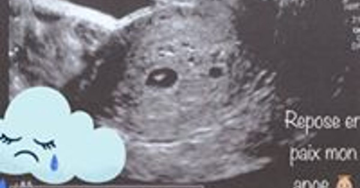 Jessica Leblanc-Pouliot' History | Mixcloud